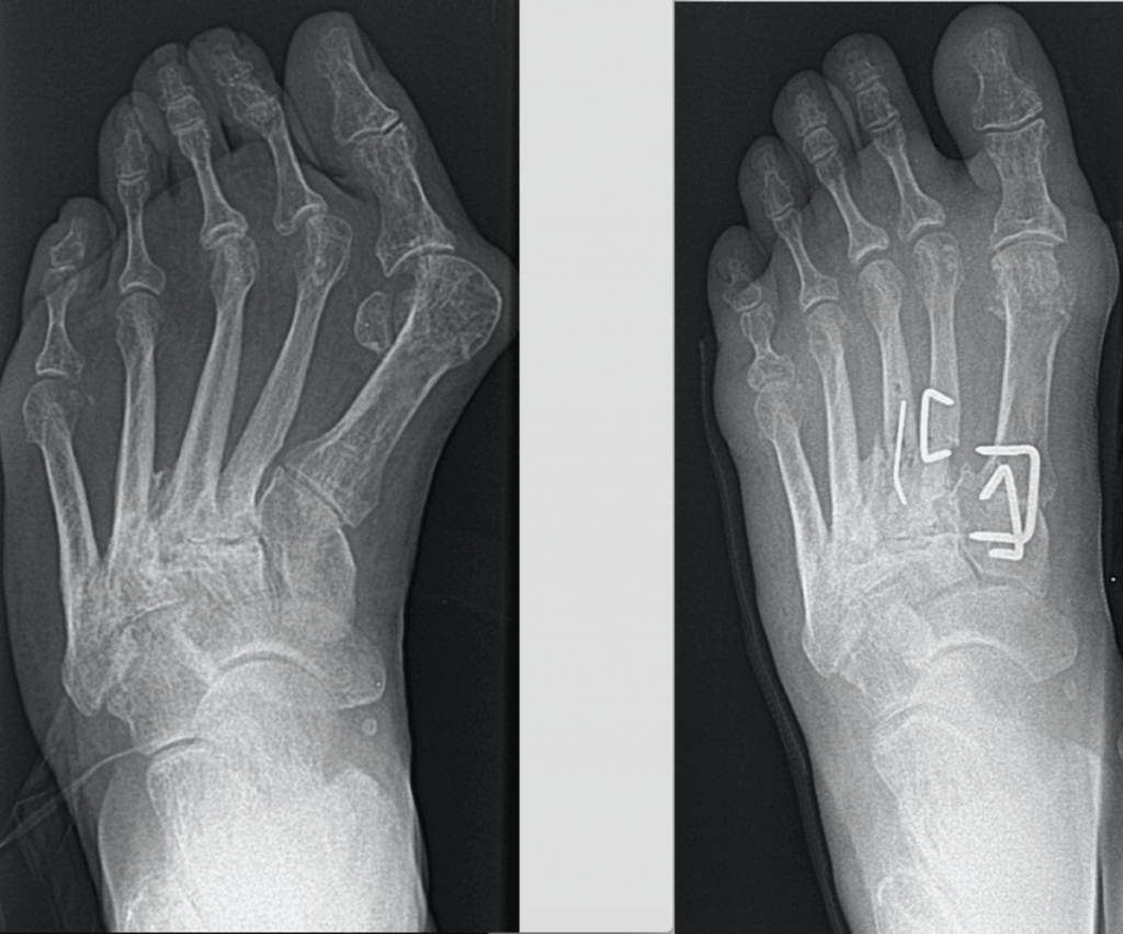 Pediatrics - Tarzana Foot Center